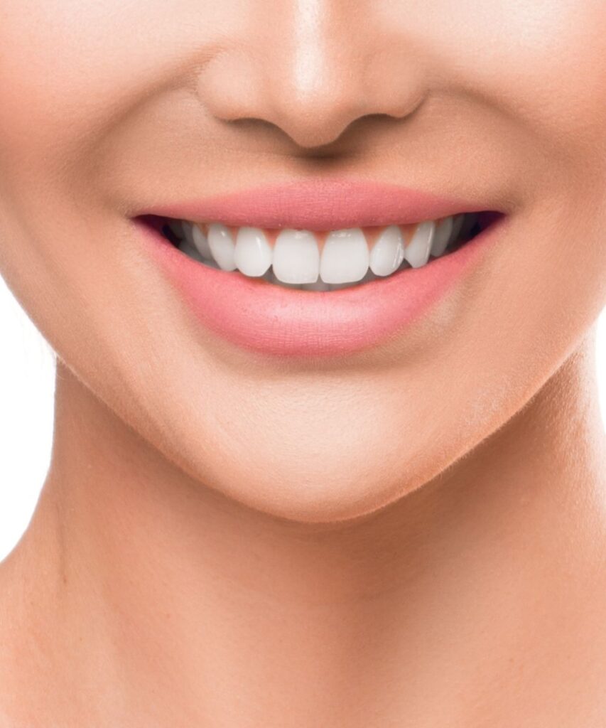Teeth Whitening in Romford | Beauty Aesthetics Clinic